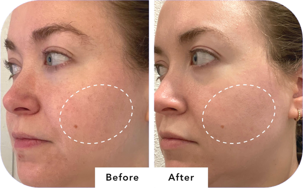 Run Beauty Consumer Studies | Good Face