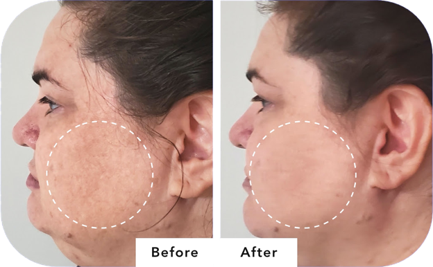 Run Beauty Consumer Studies | Good Face